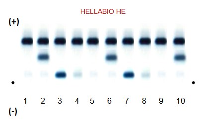 Hellabio - HE10 / MHE - Hemoglobin Electrophoresis kit by ...