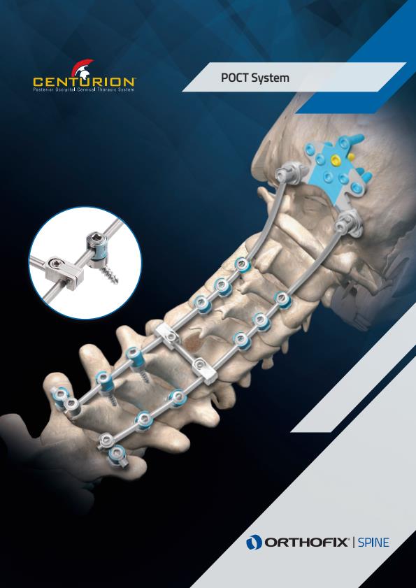 Centurion - Posterior Occipital Cervico-Thoracic â€‹System (POCT ...
