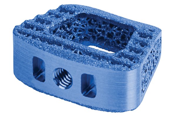 Hedron ACDF -C 3D Printed Anterior Cervical Interbody Fusion Spacer