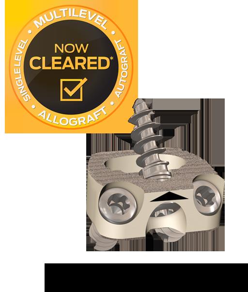 STALIF C-Ti No-Profile® Anterior Cervical Integrated Interbody System