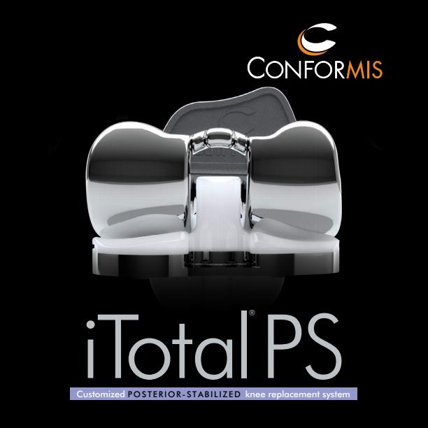 iTotal - Model PS - Total Knee Replacement System - Brochure