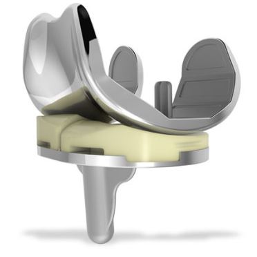 Conformis - iPoly & iPoly XE - Knee System - Inserts