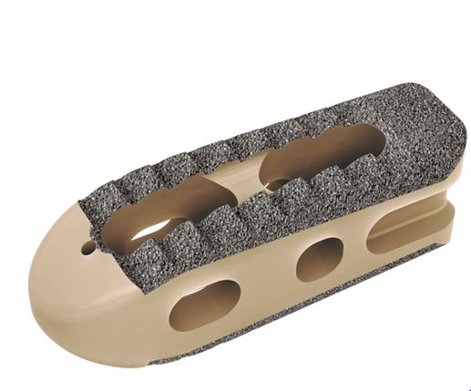 Battalion - PS - PLIF Posterior Lumbar Interbody Fusion