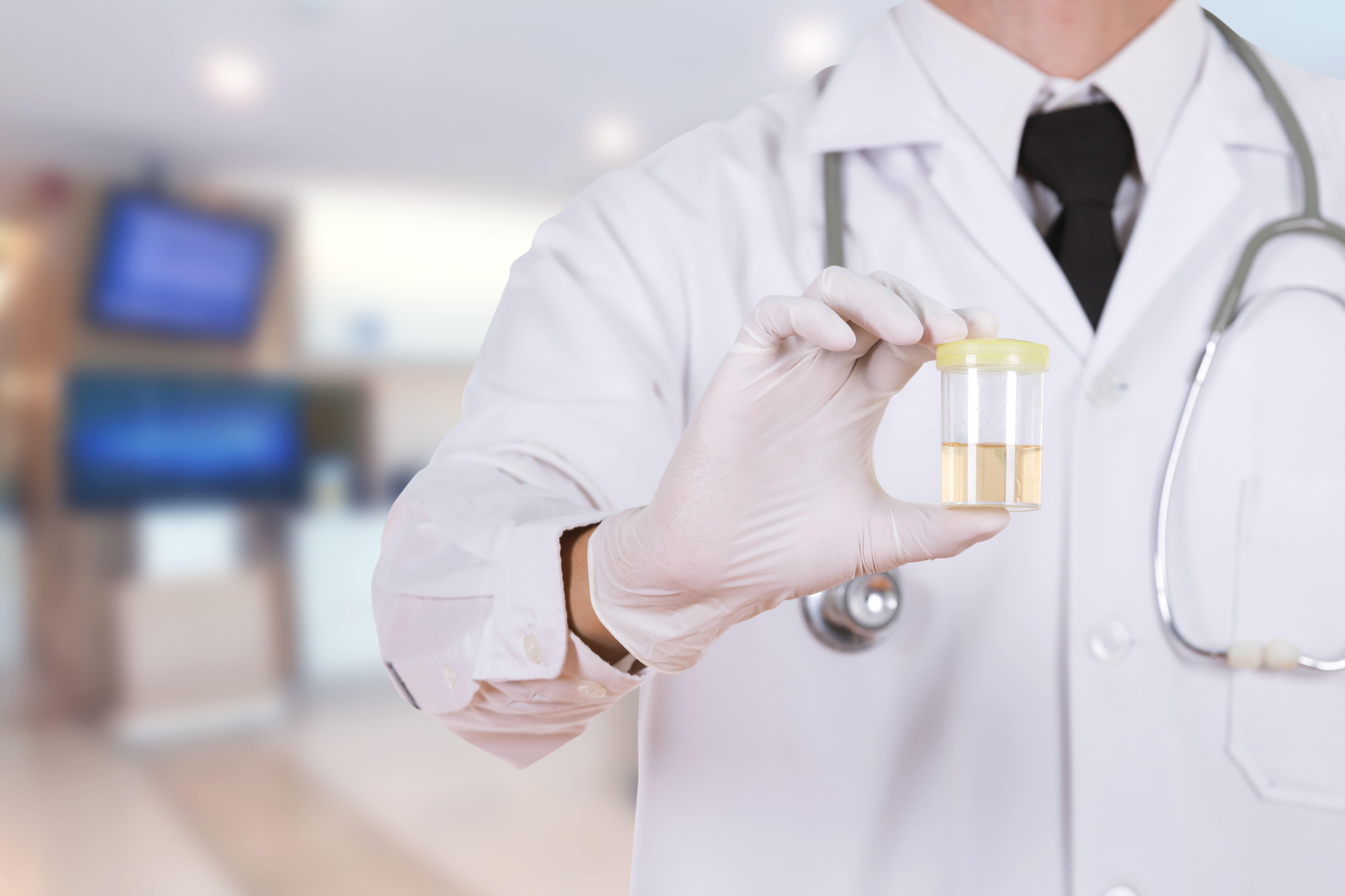 ExoDx Prostate Test: At-Home Collection Kit