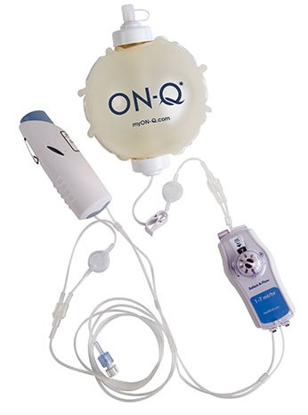 Avanos - ON-Q - Acute Pain- Acute/Surgical Pain Solutions