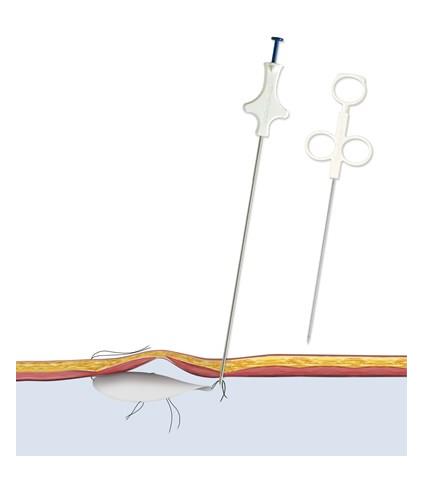Carter-Thomason Suture Passer