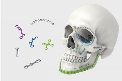 Leforte II Oral Maxillofacial Bone Plate And Screw System