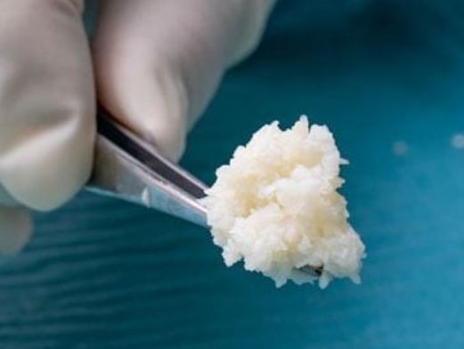 Kerecis - Omega3 MicroGraft - Physicians - Acellular Fish ...