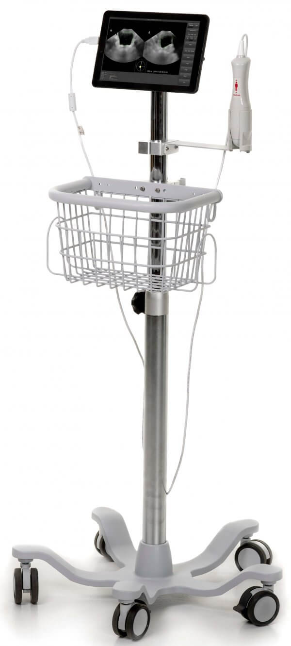 VitaScan - V.2 - VitaScan Bladder Scanner - Portable ...