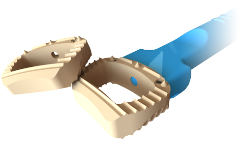 Medicrea IMPIX-MANTA - CERVICAL Range - Cervical Interbody Device By ...