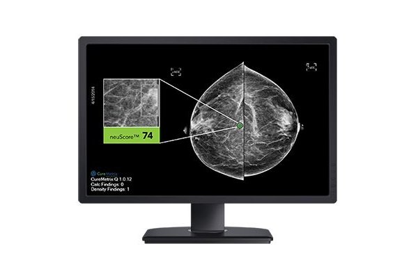CureMetrix cmAssist Investigational Computer-Aided Detection (CAD) Software