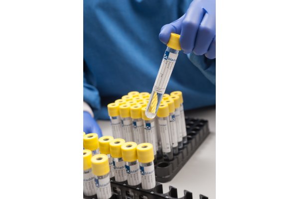 Cxbladder Urine Sampling System