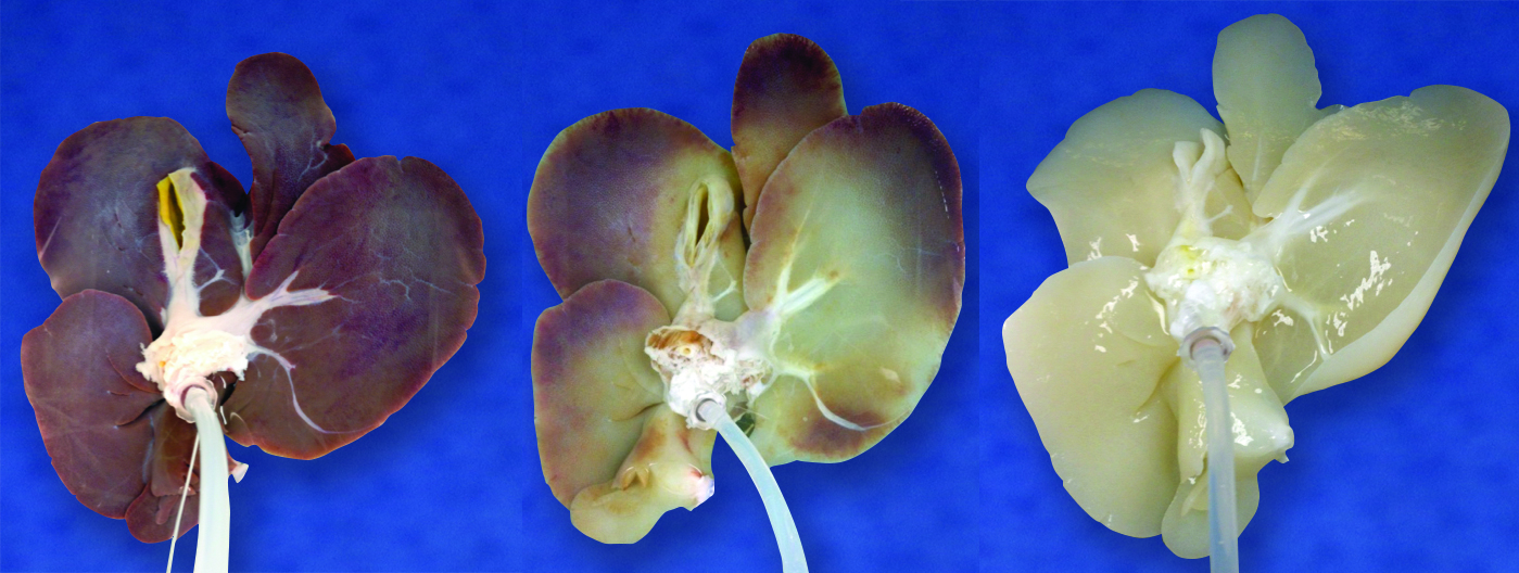 Perfusion Decellularization Technology by Reprise Biomedical