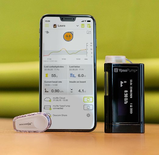 mylife - Loop Program1 - Diabetes Care - Modular Insulin Pump ...