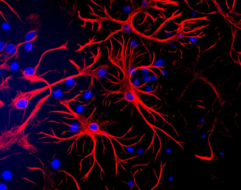 GFAP - Primary Antibody - Anti-Glial Fibrillary Acidic ...