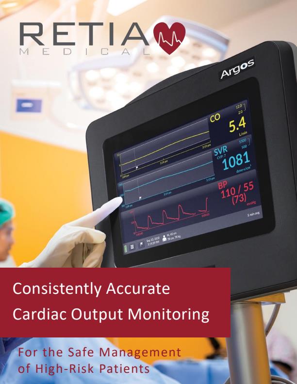 Argos - Cardiac Output Monitor - Brochure