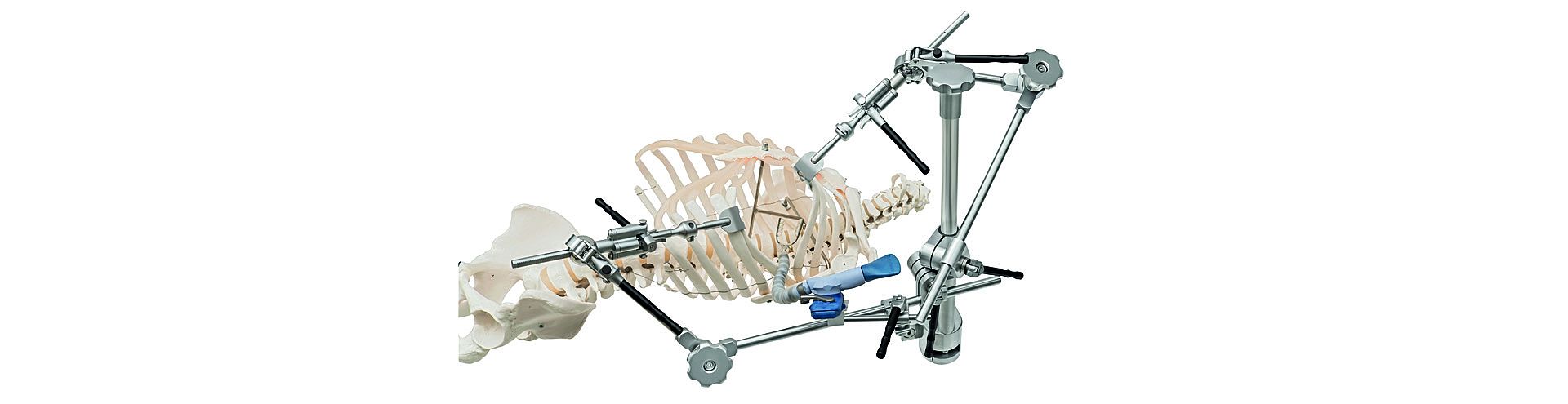 Martract MIDCAB Rib Retractor System