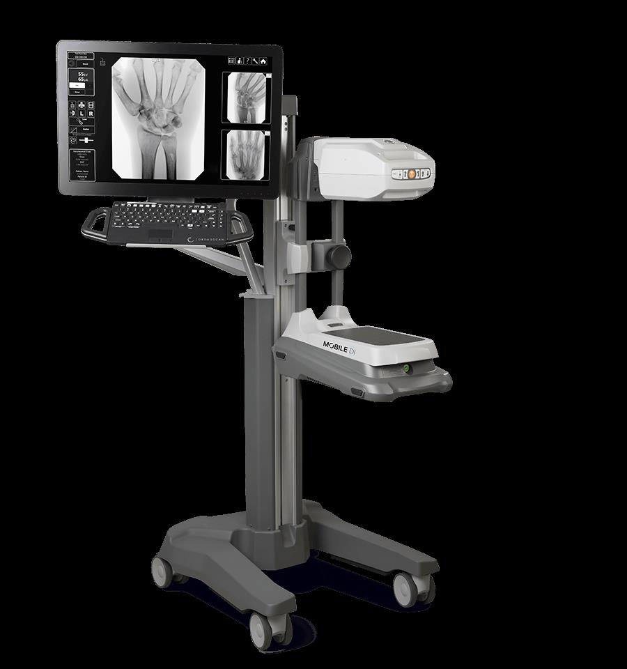 Orthoscan Mobile DI - Clinical Mini C-Arms - Portable ...