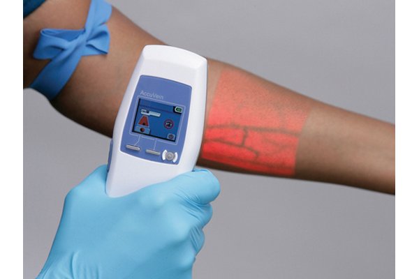 IMS AccuVein AV400 Vein Viewing System