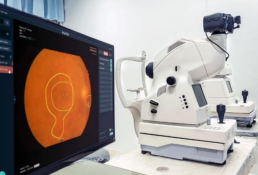 Vuno Med - Fundus AI - X-Ray Image Analysis Software By Vuno ...
