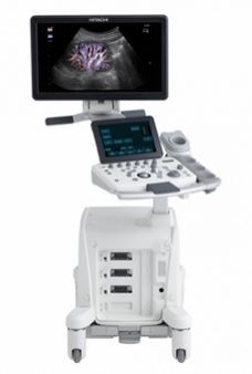 Arietta - 50 - Ultrasound - Color Dopplers - Comprehensive ...
