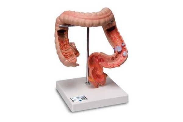 3B Scientific - Anatomical Models - Digestive System Models - Smart ...