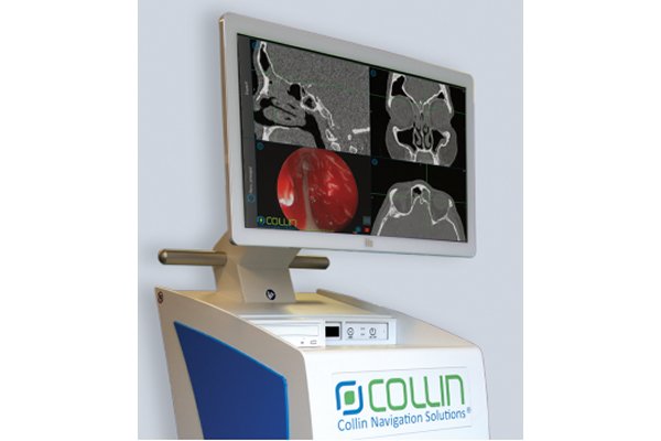 Collin - Chirurgical Navigation - ENT Surgical Navigation ...