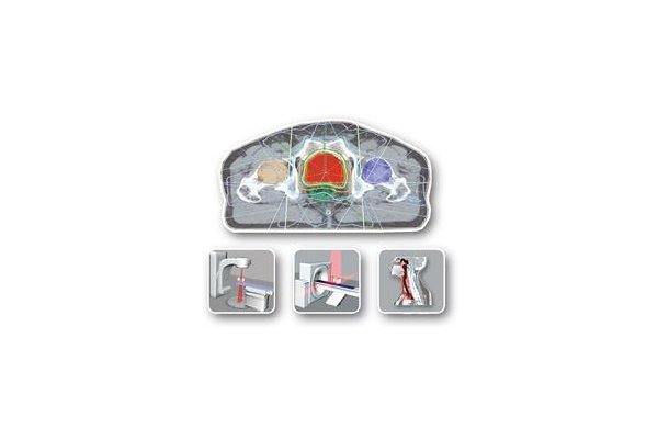 Tigrt TPS Radiation Treatment Planning System