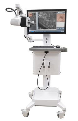 Vivascope 1500 In Vivo Reflectance Confocal Microscope