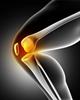 Knee Osteoarthritis - Medical / Health Care - Clinical Services ...