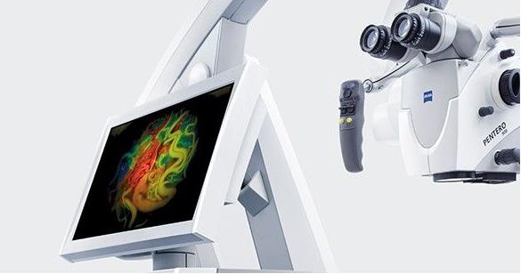 Zeiss Flow - 800 - Neurosurgery - Intraoperative Fluorescence ...