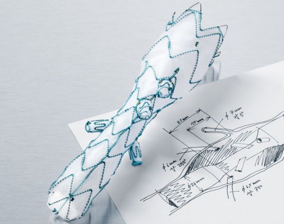 JOTEC - E-Xtra Design Engineering - MultiBranch Stent Graft ...