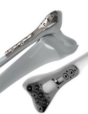 MAT - [Ti] Win - Raduis Plates By MAT Gmbh & Co. KG