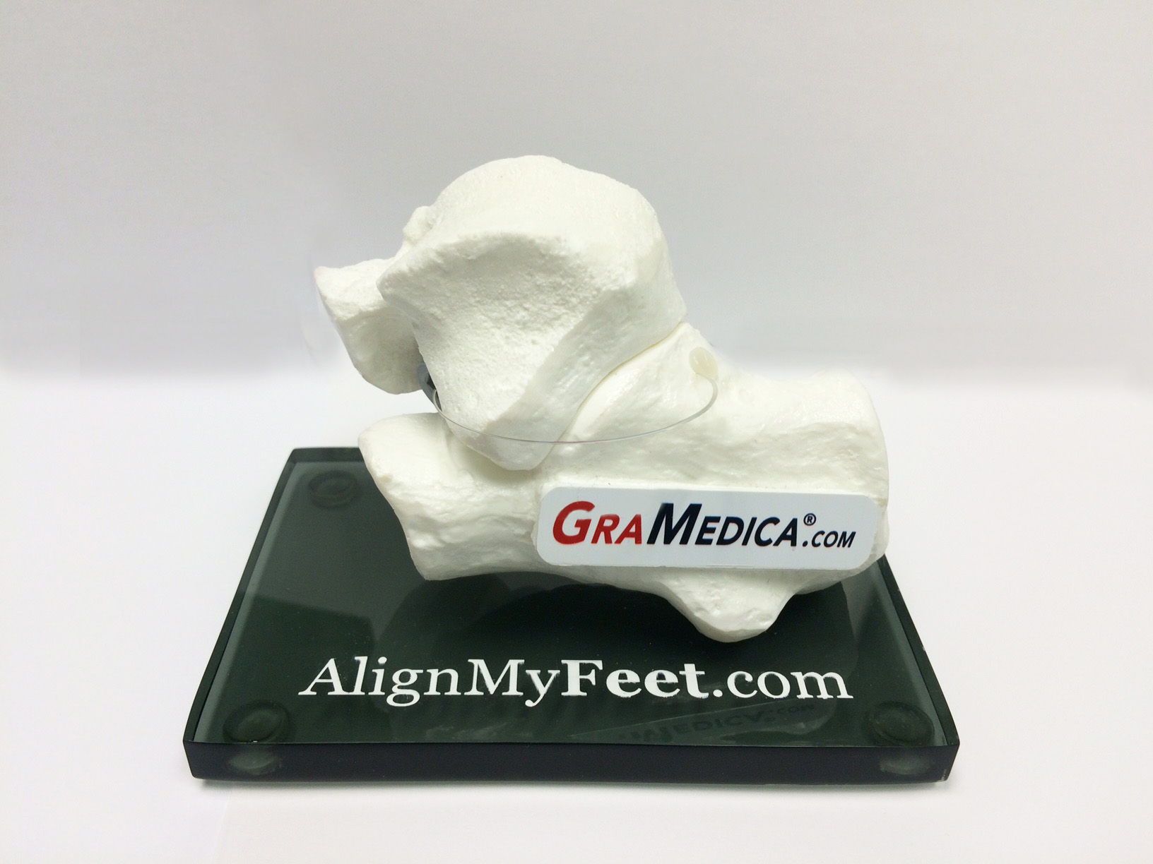 AlignMyFeet - Magnetic Foot Models by GraMedica