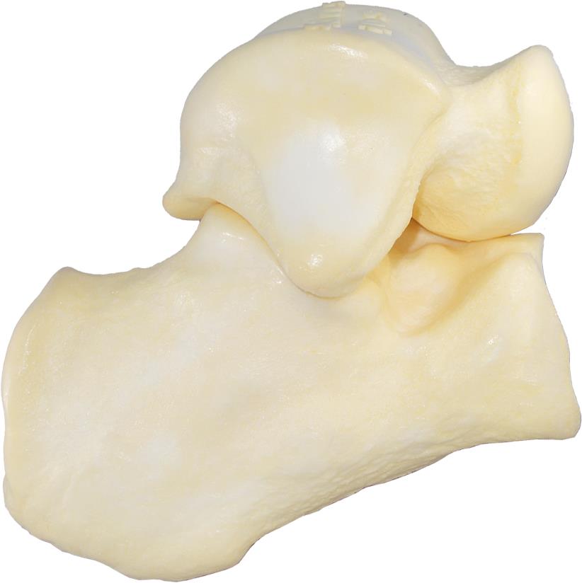 Talus and Calcaneous Bone Model by GraMedica