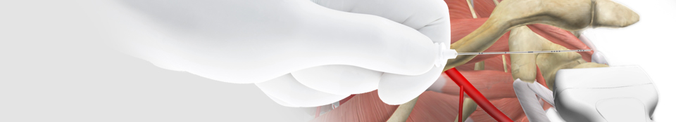 eZono - Licensing - Needle Guidance Technology by eZono AG