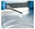 AmnioGuard Umbilical Cord Graft Tissue