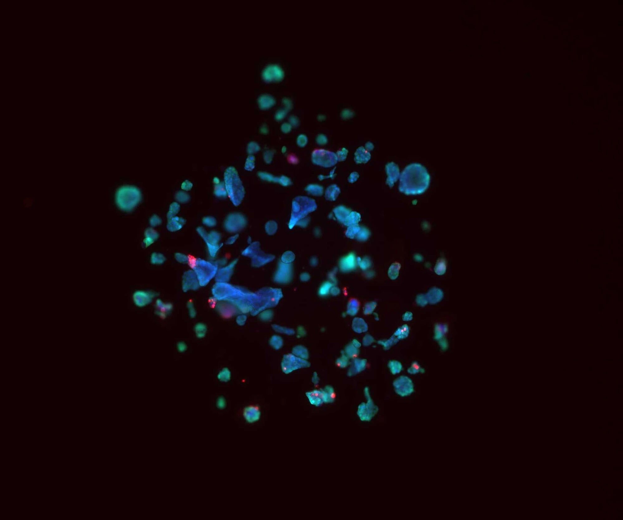 3D bioprinting technology for prostate disease - Medical