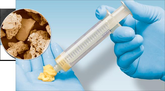 I2b Biov - Biologics - Bone Putty By In2bones Global