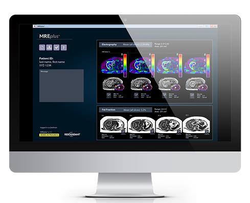 Mreplus+ MRI–Based Diagnostic Imaging Software