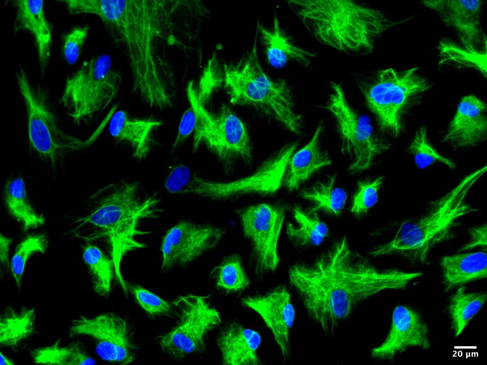 Cytes - HuSC - Human NPCs - Primary Human Hepatic Stellate ...