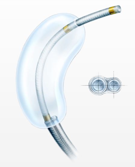 Eclipse - 2L - Double Lumen Balloon Catheter by Balt USA LLC.