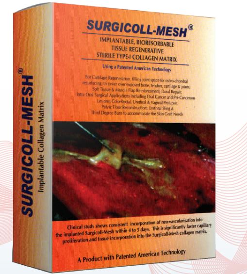 EnColl Surgicoll-Mesh Implantable, Bioresorbable Tissue Regenerative ...