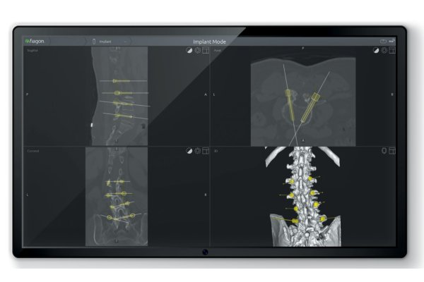Fiagon VirtuSuite SPINE Navigation Software