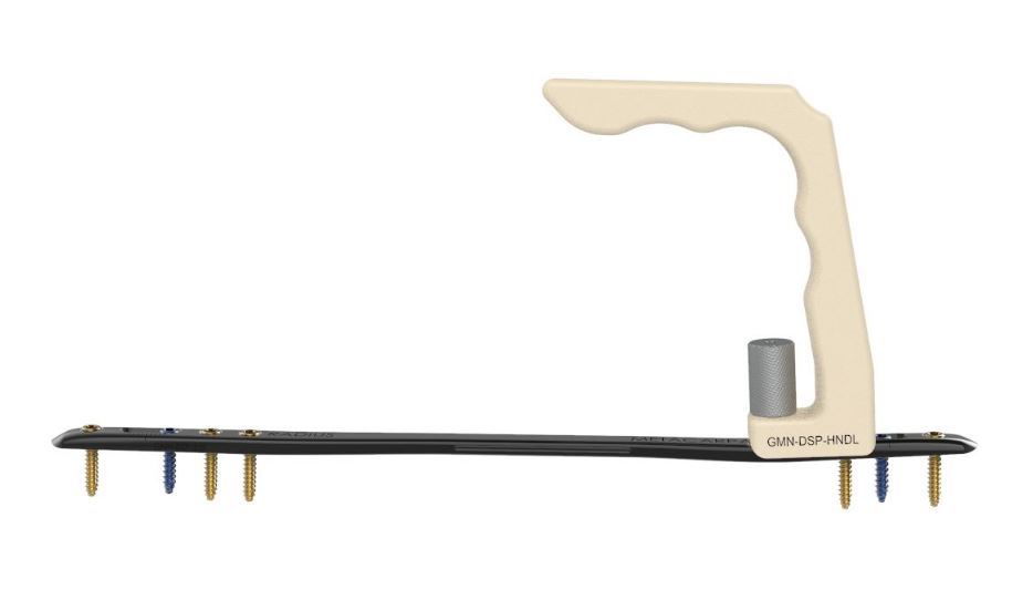 Wrist & Forearm Set - Dorsal Spanning Plate by Skeletal ...