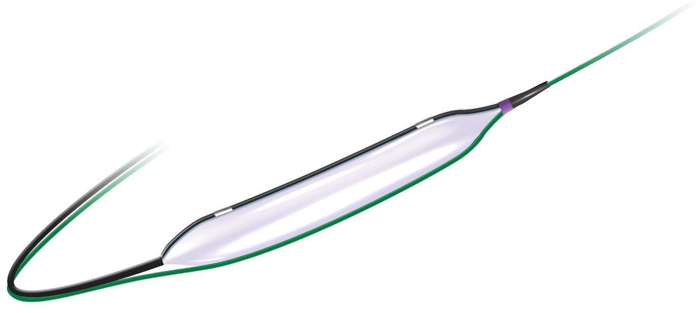 Scoreflex NC Coronary Dilatation Catheter