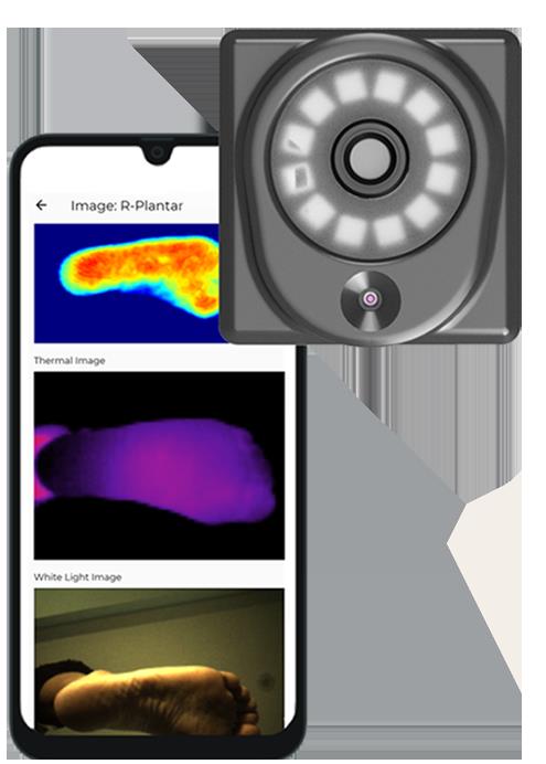 MIMOSA - Transforming Skin Health Small and Mighty Device by ...