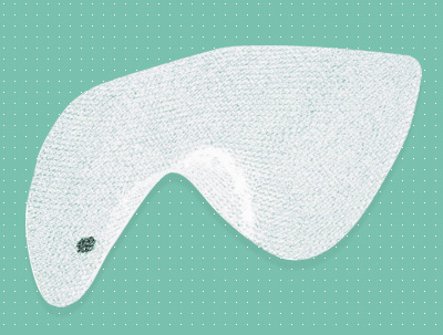 MicroVal - JG - Hernias Coelio - Treatment of Inguinal ...