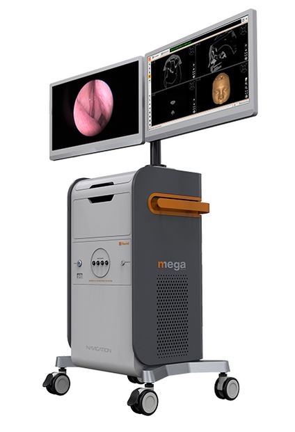 Naviol - ENT Navigation - ENT Navigation System By Mega ...