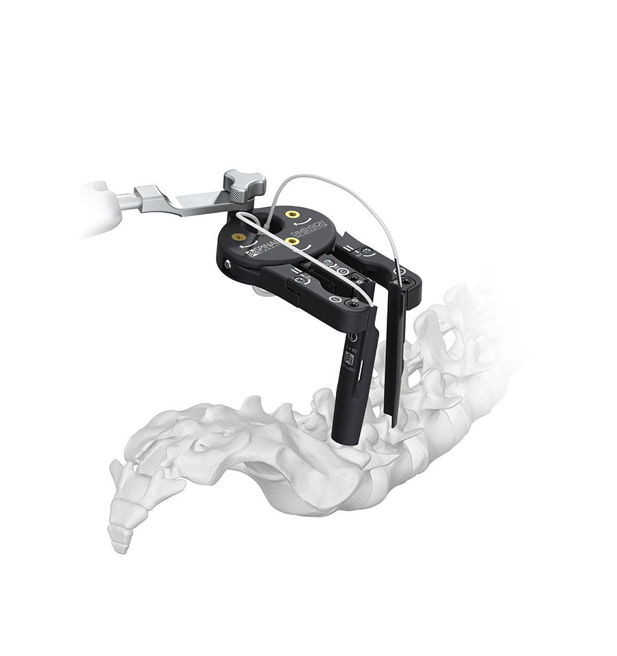 Cardiac Dimensions - MIS TLIF - Access Systems - Retractor ...